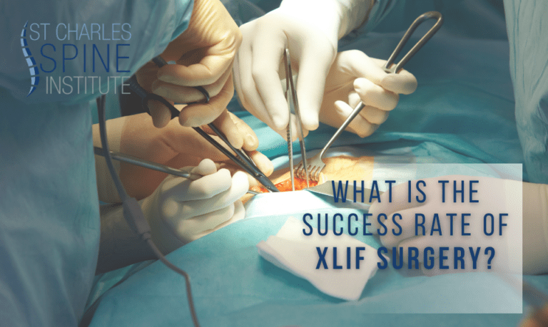 What Is the Success Rate of XLIF Surgery? - St. Charles Spine Institue