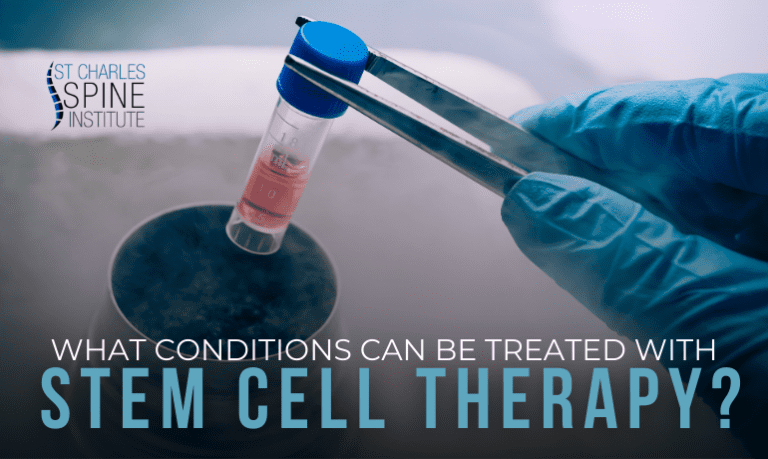 What Conditions Can Be Treated with Stem Cell Therapy? - St. Charles ...