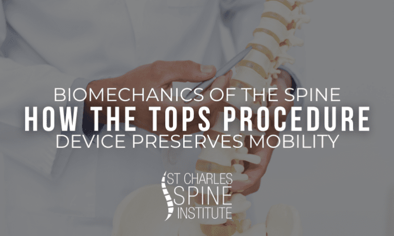 Biomechanics of the Spine: How the TOPS Device Preserves Mobility - St ...