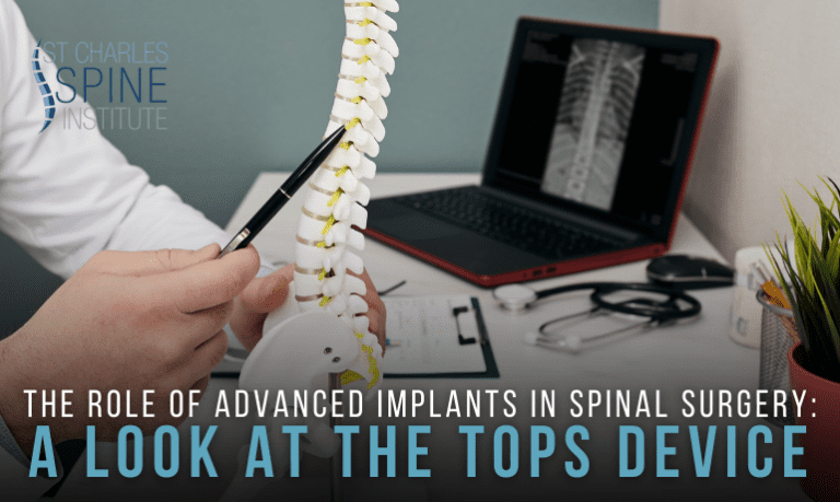 The Role of Advanced Implants in Spinal Surgery: A Look at the TOPS ...