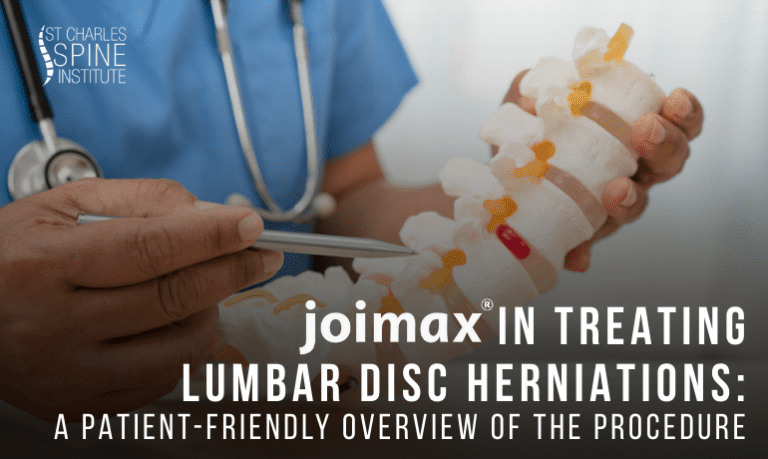 joimax® in Treating Lumbar Disc Herniations: A Patient-Friendly ...